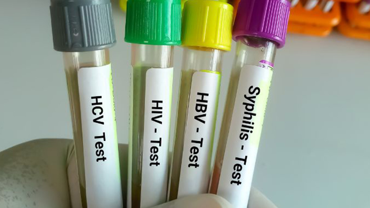 Alerte OMS : Les IST en hausse dans de nombreuses régions, menaçant les ...